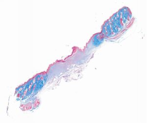 Digital Slide Scanning – CaresBio Laboratory